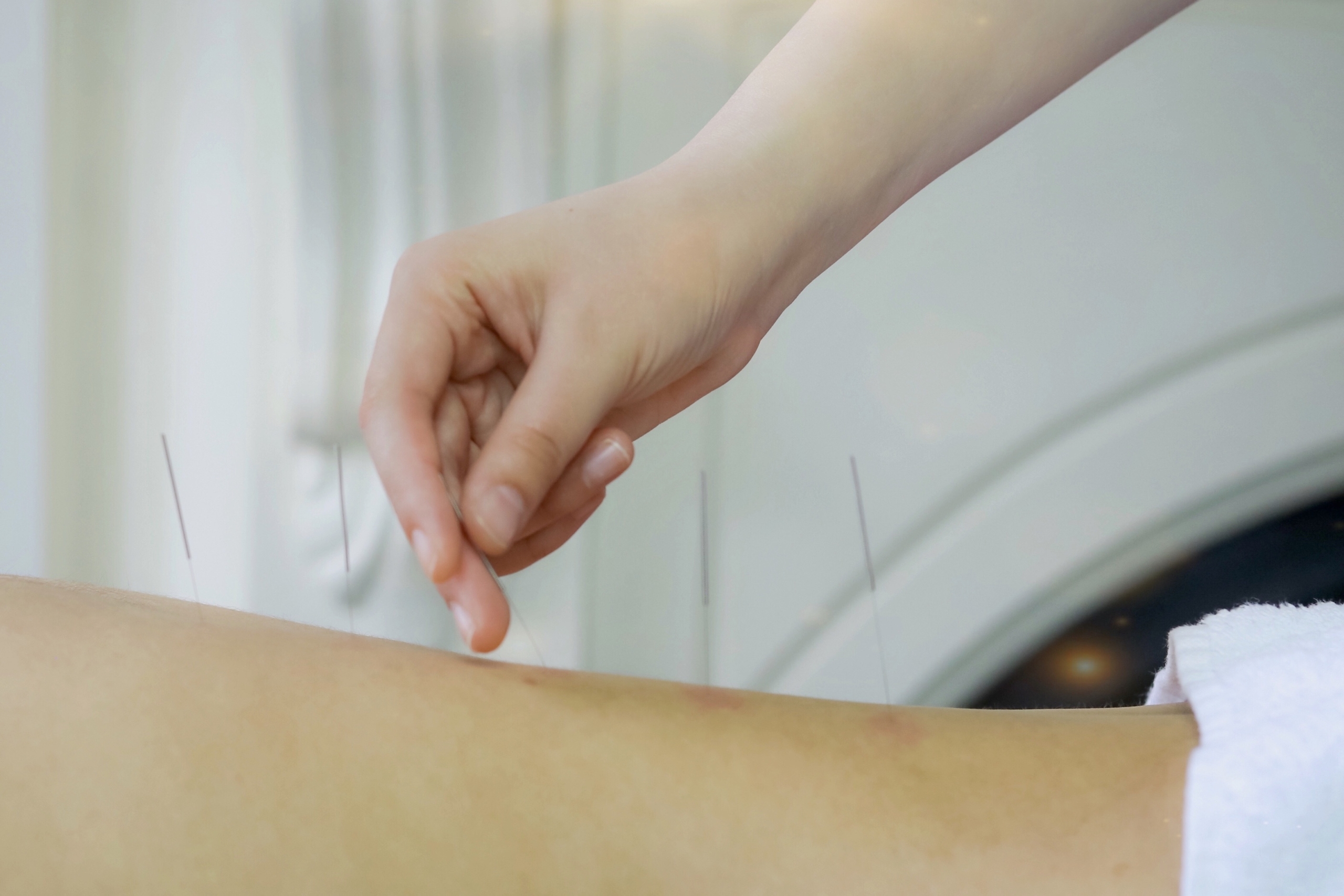 Treatment & Fees | Acupuncture | Superior Health Ltd